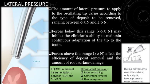 Sonic & ultrasonic instruments | PPTX | Dental Health | Diseases and ...