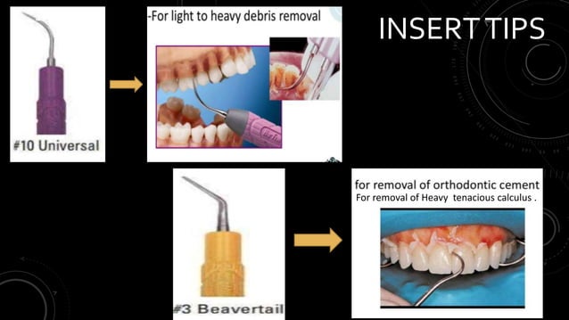 Sonic & ultrasonic instruments | PPTX | Dental Health | Diseases and ...