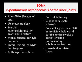 Sonk | PPTX