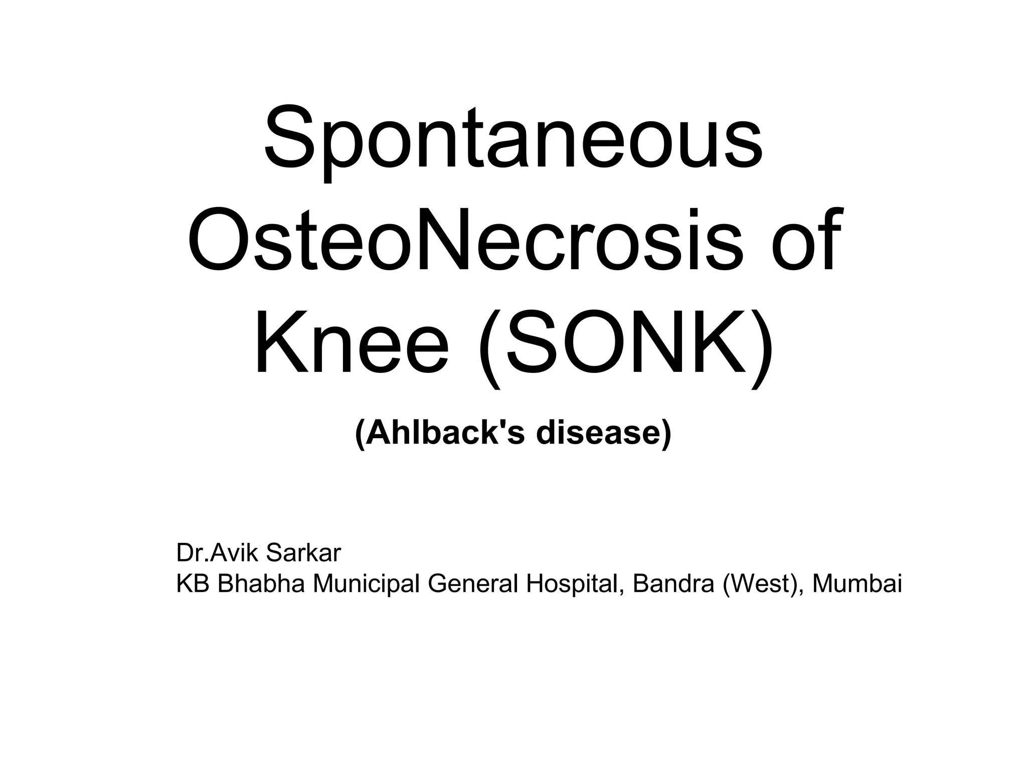 Spontaneous OsteoNecrosis of Knee (SONK) | PPT