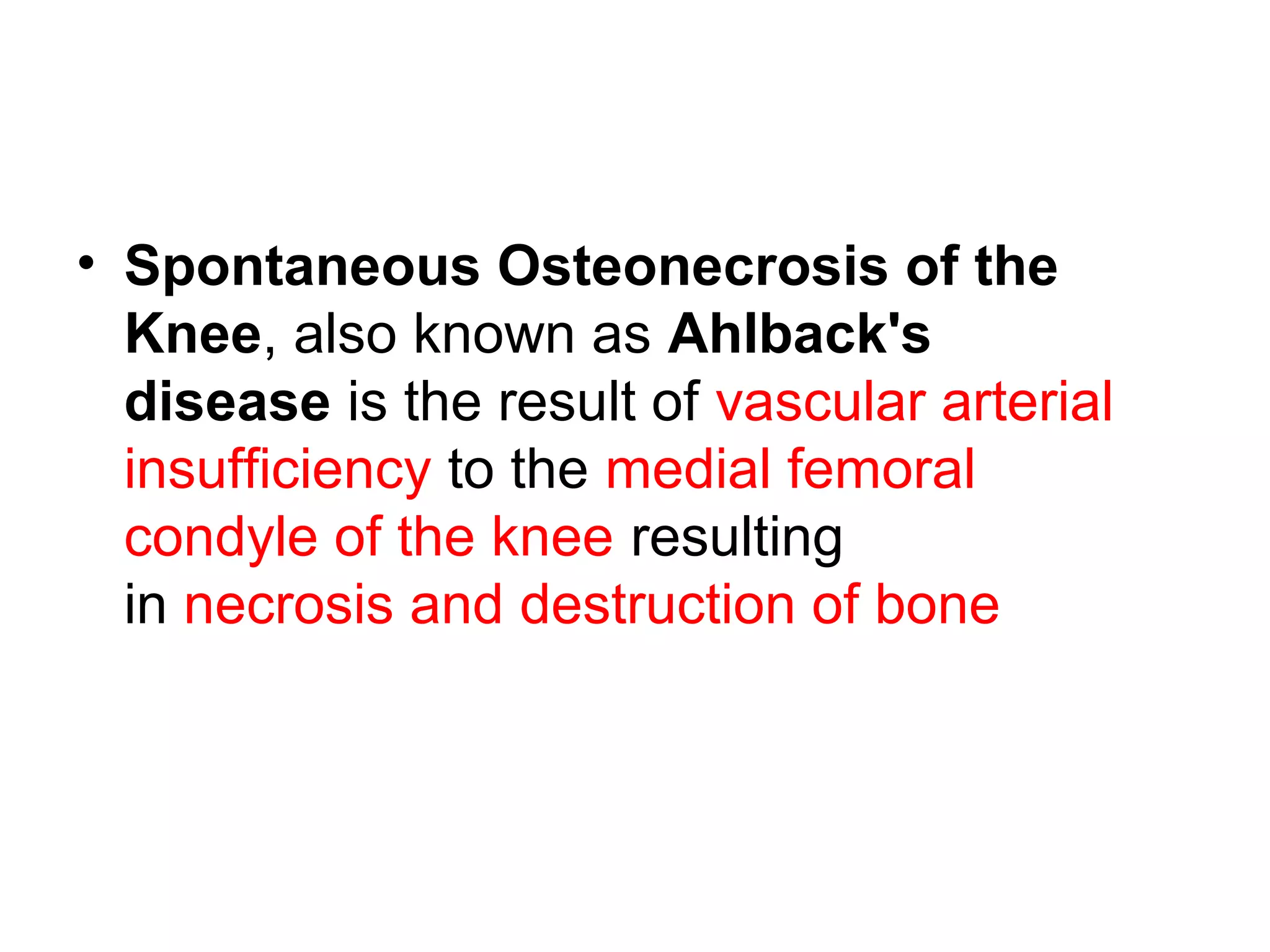 Spontaneous OsteoNecrosis of Knee (SONK) | PPT