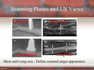 Applied Sonoanatomy | PPT