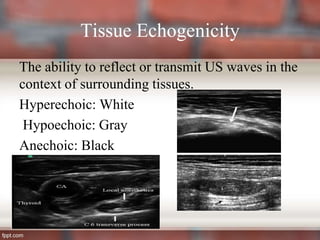 Applied Sonoanatomy | PPT