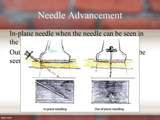 Applied Sonoanatomy | PPT