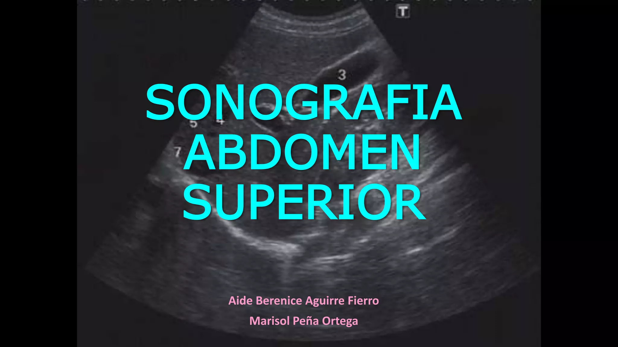 Sonografia abdomen superior | PPT