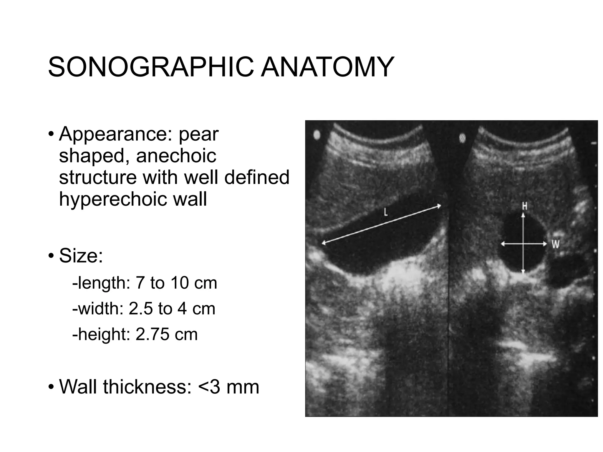 Sonographic anatomy of abdomen and pelvic organ | PPTX