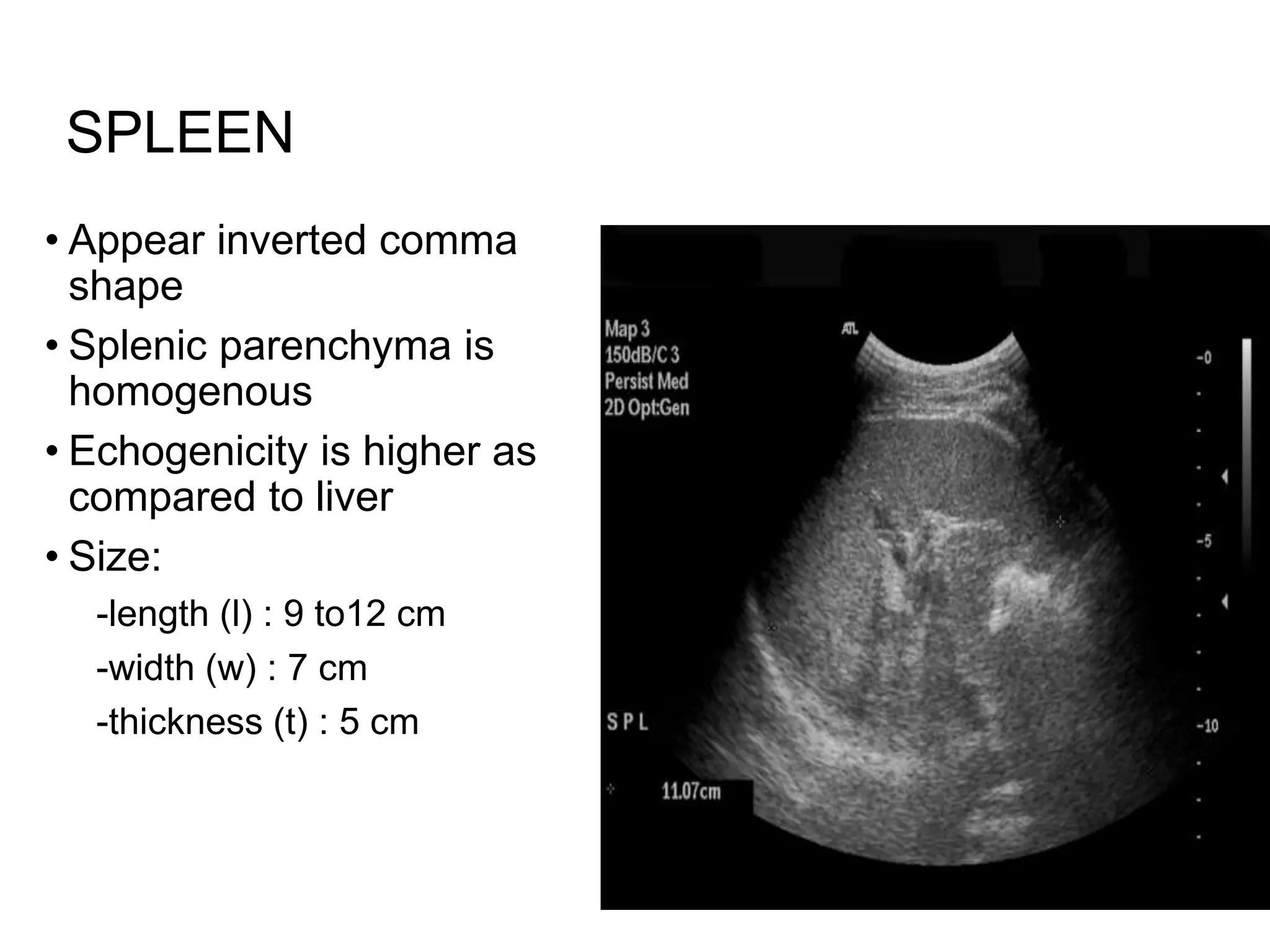 Sonographic anatomy of abdomen and pelvic organ | PPTX