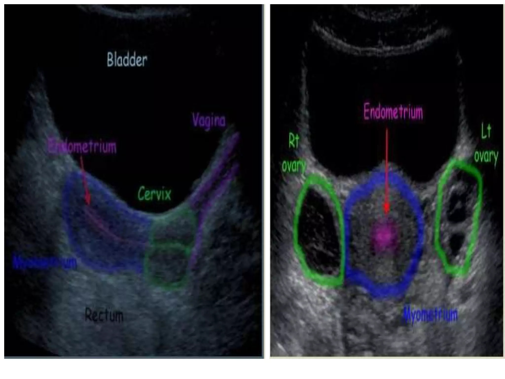 Sonographic anatomy of abdomen and pelvic organ | PPTX
