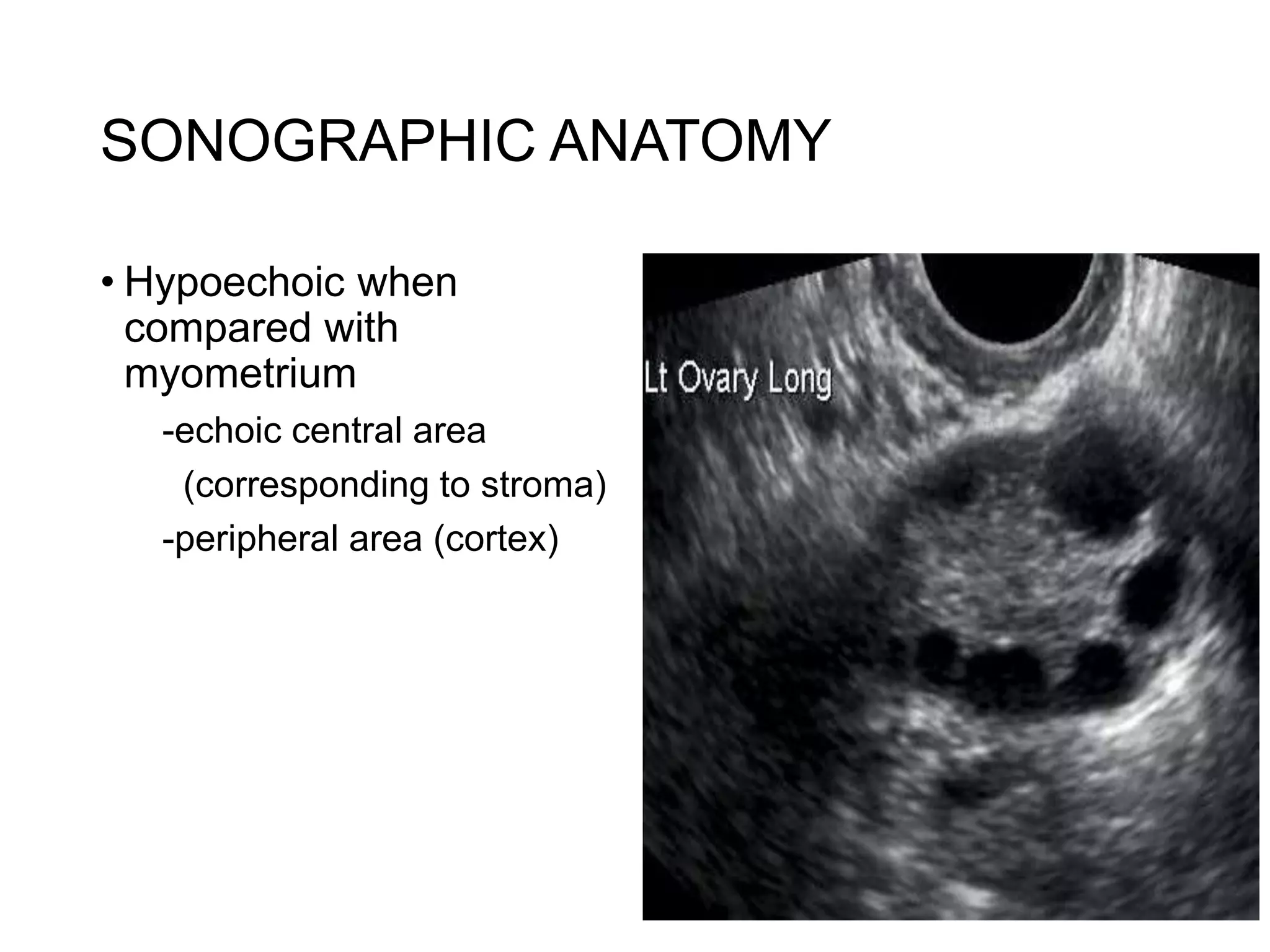 Sonographic anatomy of abdomen and pelvic organ | PPTX