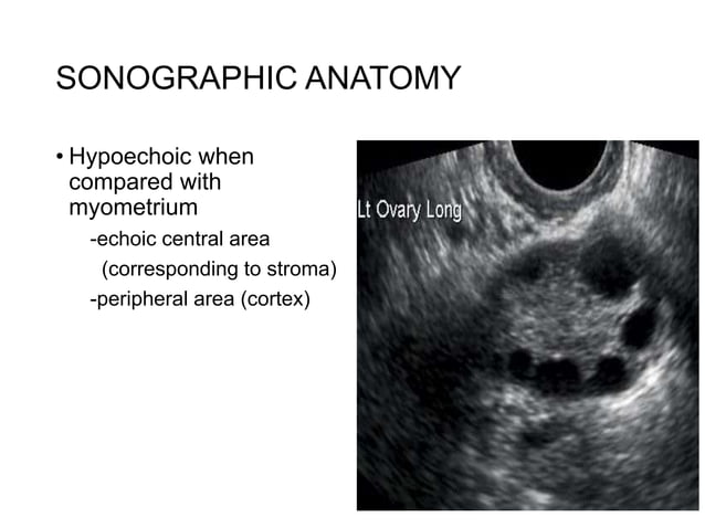 Sonographic anatomy of abdomen and pelvic organ | PPTX