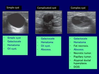 Sonographic evaluation of breast Dr. Muhammad Bin Zulfiqar | PPT