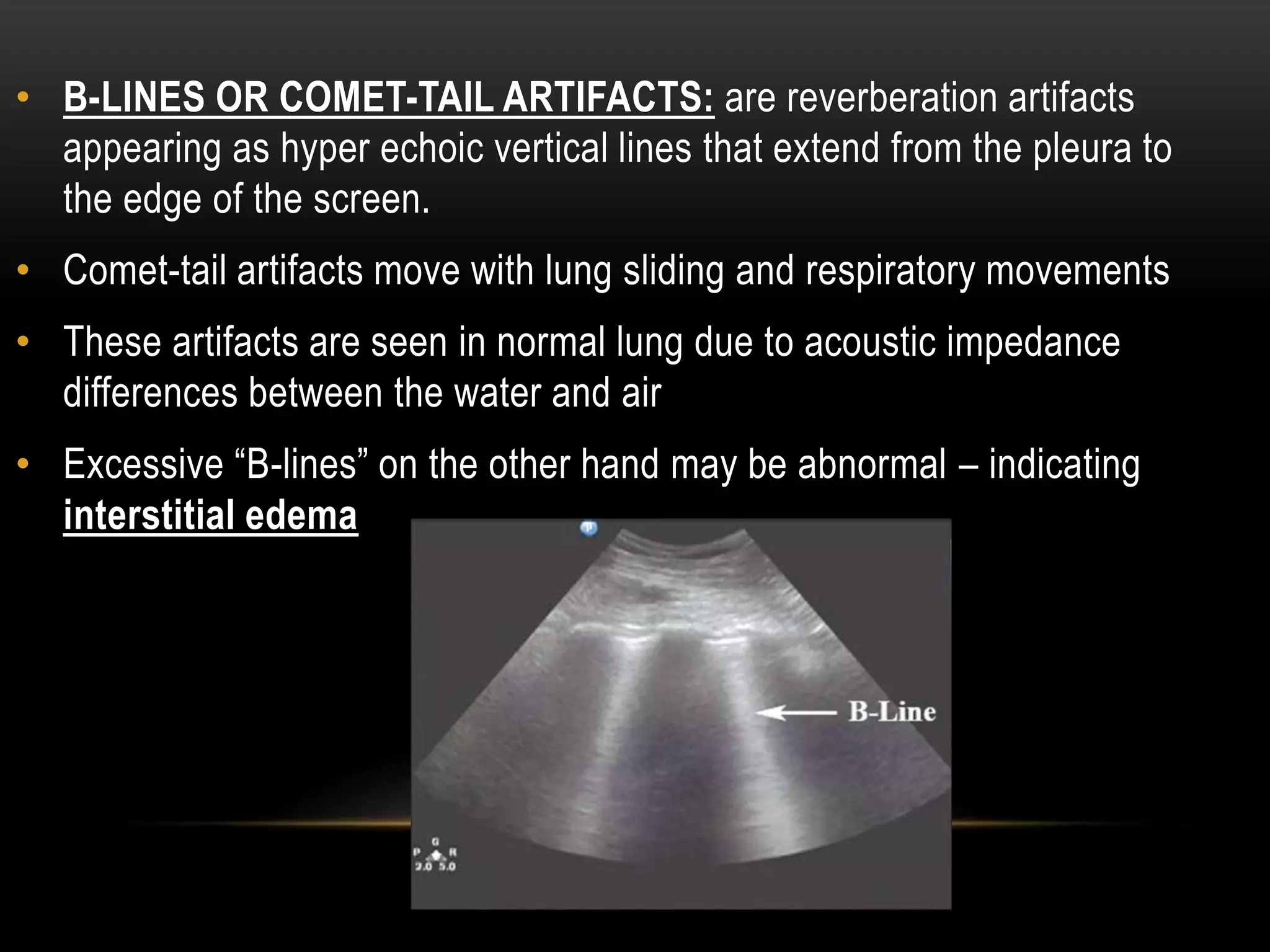 Sonographic features of pneumothorax dr suresh | PPTX