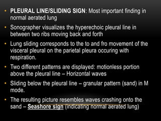 Sonographic features of pneumothorax dr suresh | PPTX