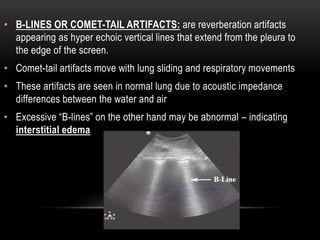 Sonographic features of pneumothorax dr suresh | PPTX