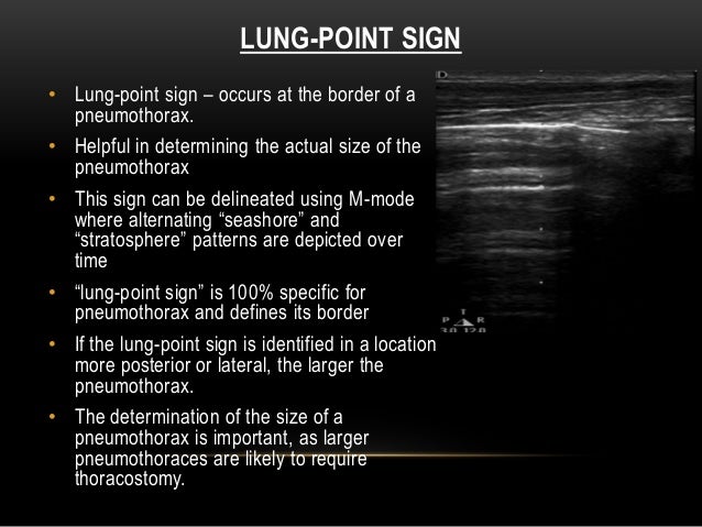 Sonographic features of pneumothorax dr suresh
