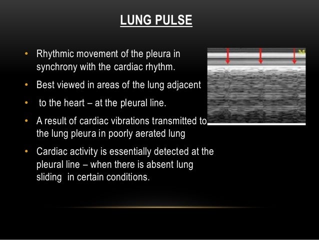 Sonographic features of pneumothorax dr suresh