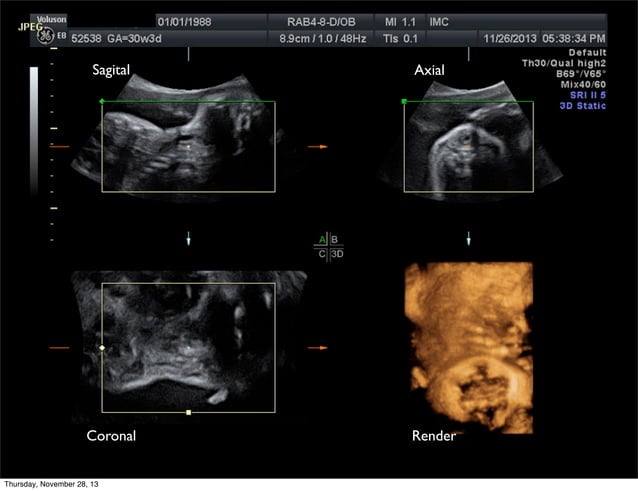 Sonography of fetal GIT | PDF