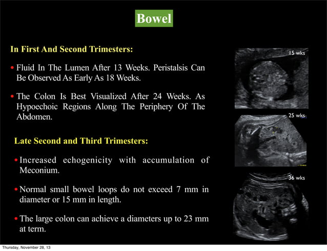 Sonography of fetal GIT | PDF