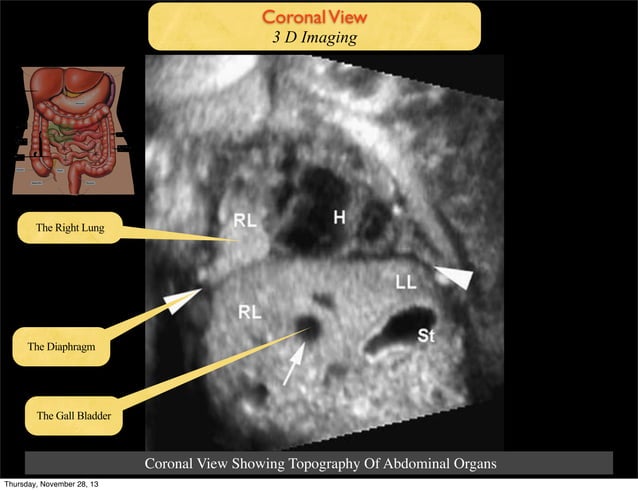Sonography of fetal GIT | PDF
