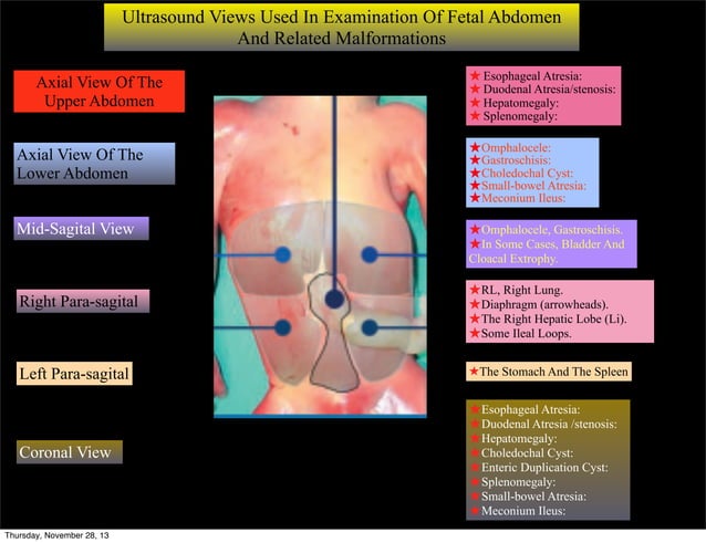 Sonography of fetal GIT | PDF