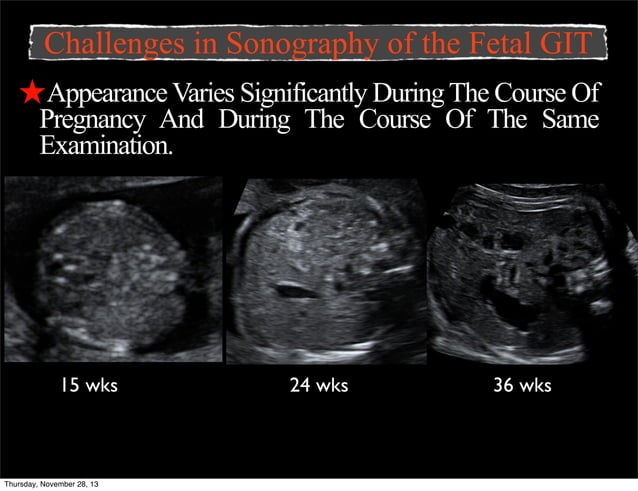 Sonography of fetal GIT | PDF