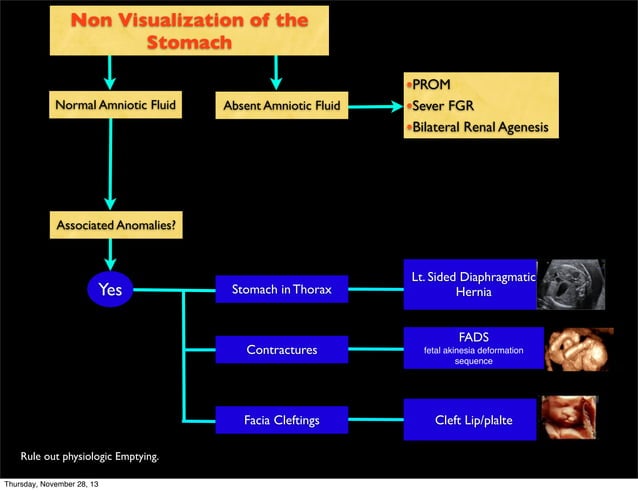 Sonography of fetal GIT | PDF