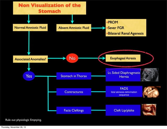Sonography of fetal GIT | PDF