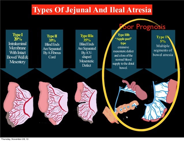 Sonography of fetal GIT