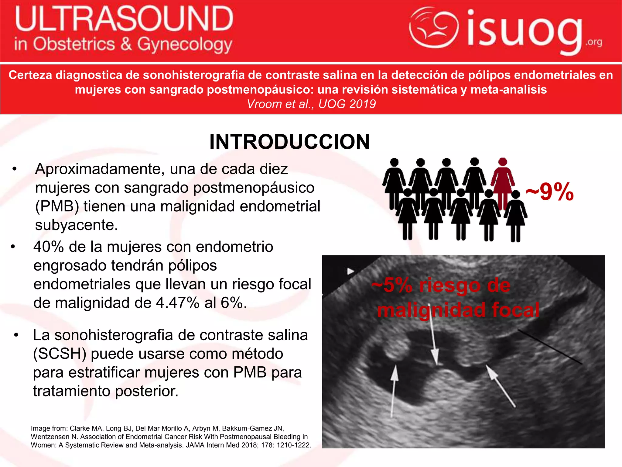 Sonohisterografía Sangrado uterino.pptx