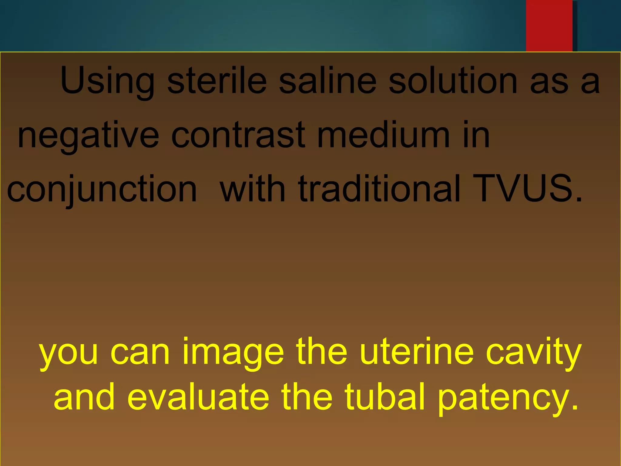 Sonohysterography | PPT