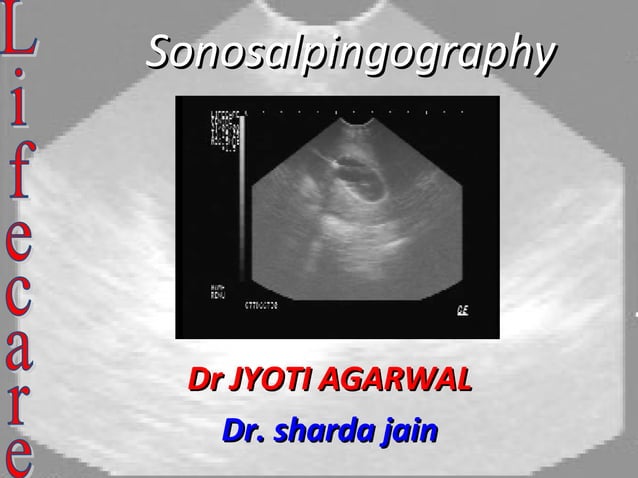 Sonosalpingography. Dr. Sharda Jain, Dr. Jyoti Agarwal | PPT