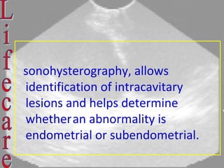 Sonosalpingography. Dr. Sharda Jain, Dr. Jyoti Agarwal | PPT