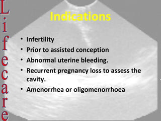 Sonosalpingography. Dr. Sharda Jain, Dr. Jyoti Agarwal | PPT