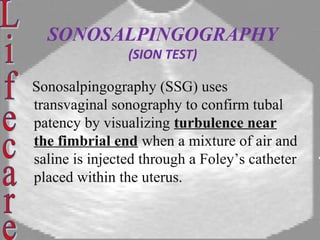 Sonosalpingography. Dr. Sharda Jain, Dr. Jyoti Agarwal | PPT