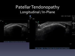 Ultrasound Guided Injections - Lower Extremity | PDF