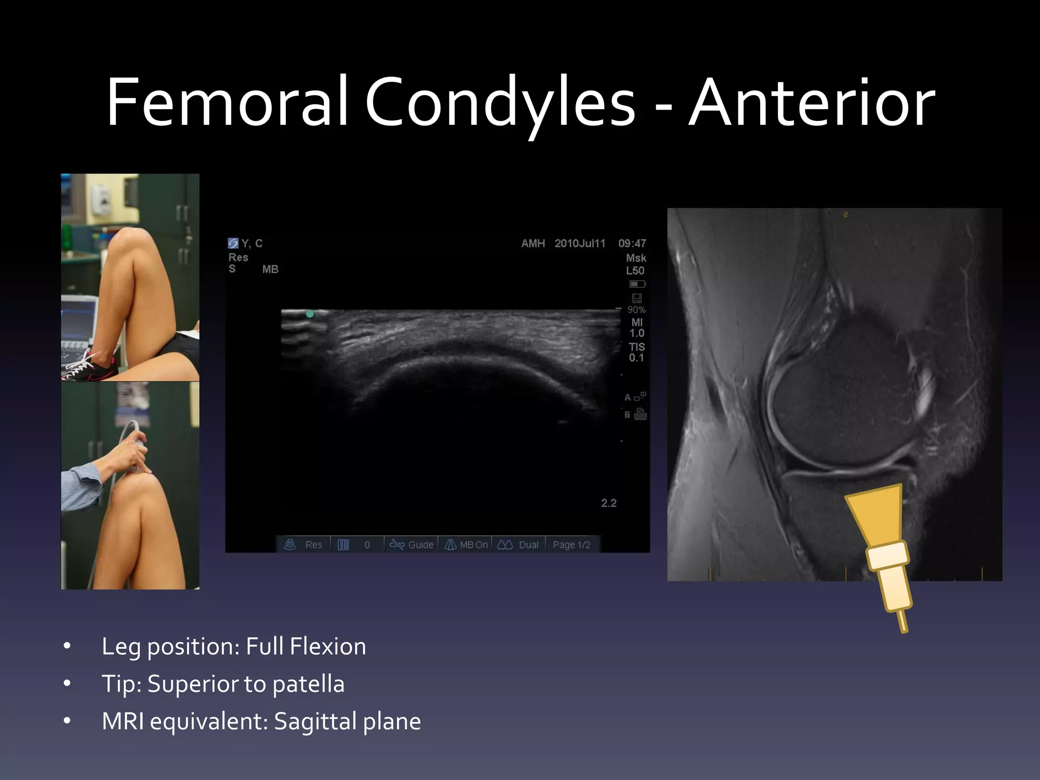 Ultrasound - Knee | PDF
