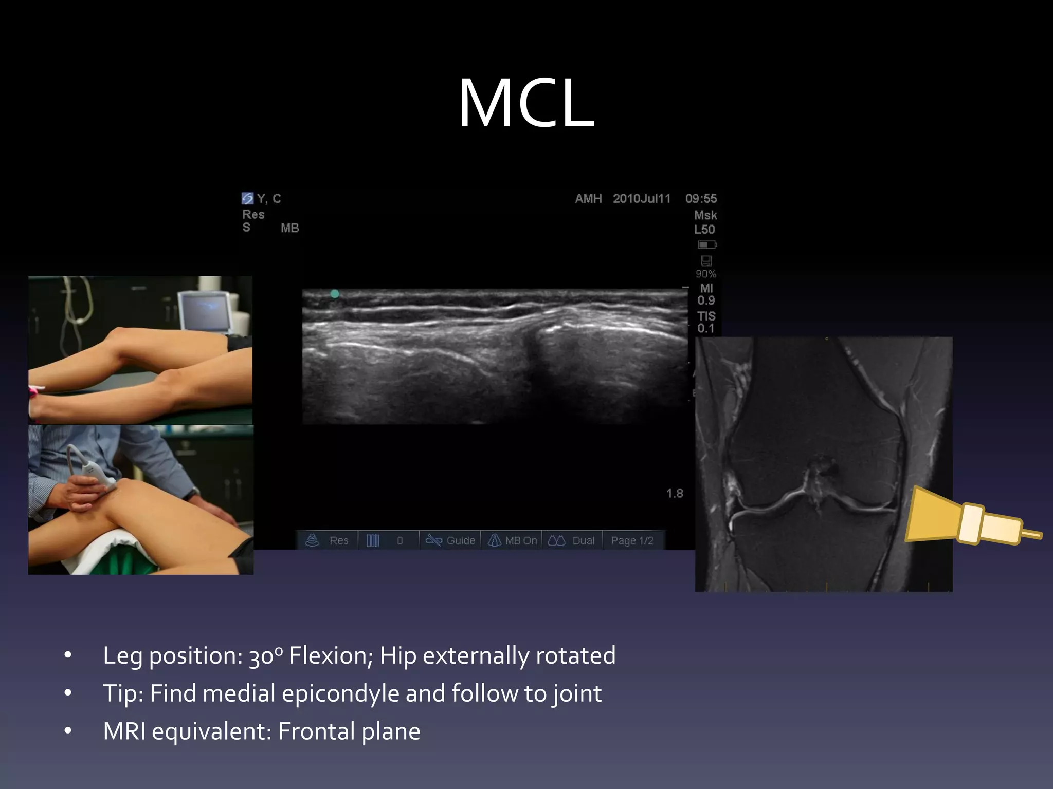 Ultrasound - Knee | PDF
