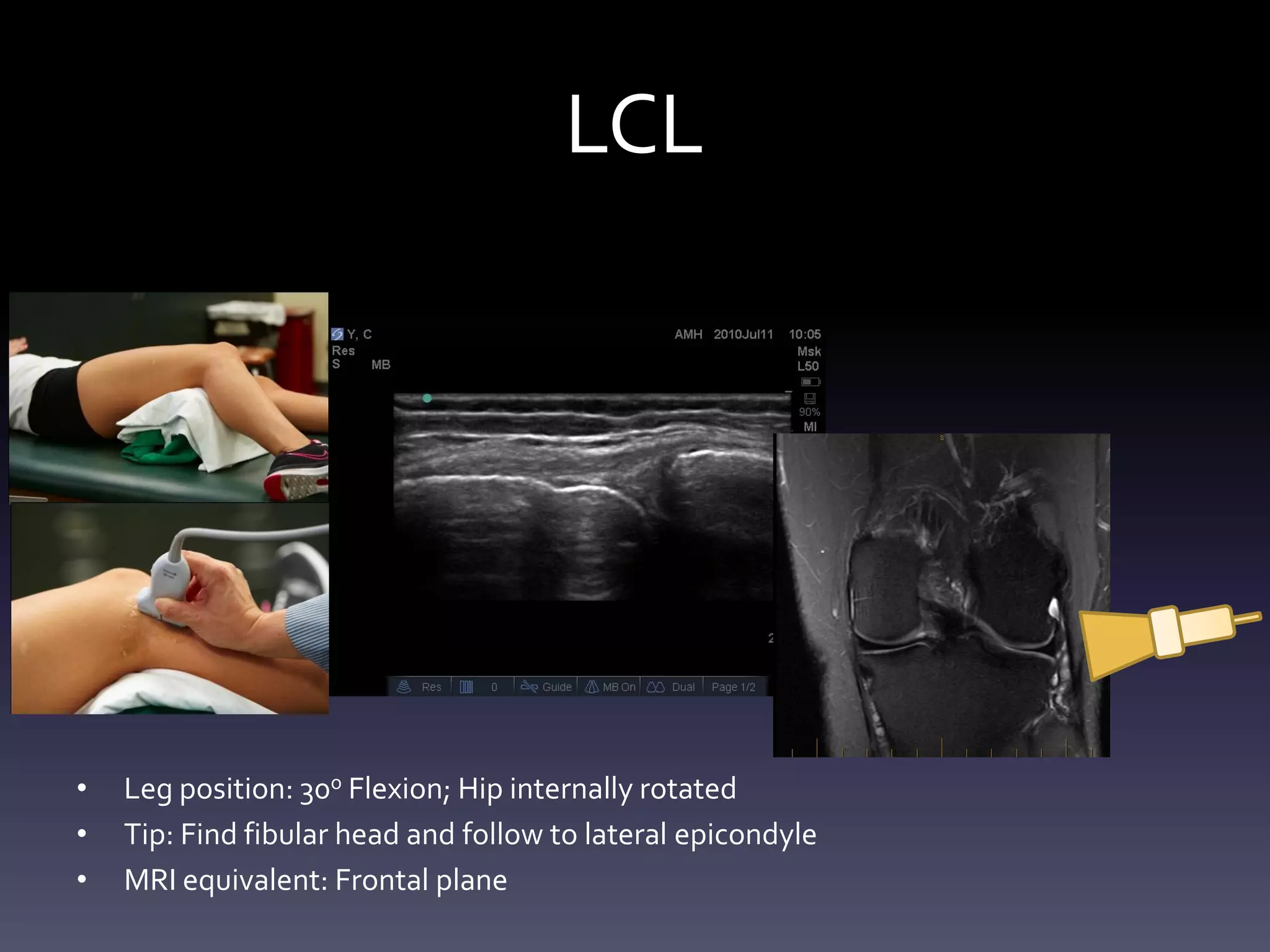 Ultrasound - Knee | PDF