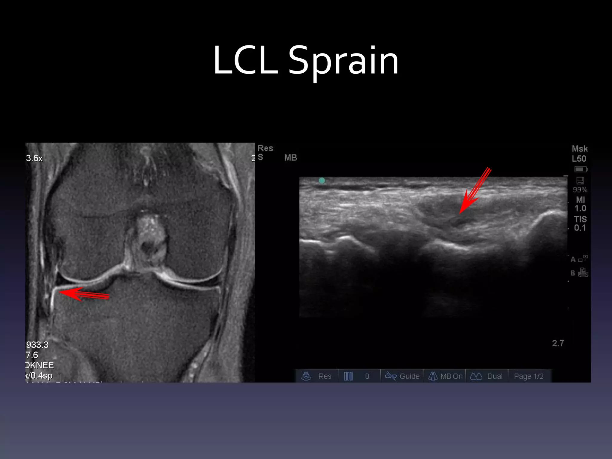 Ultrasound - Knee | PDF