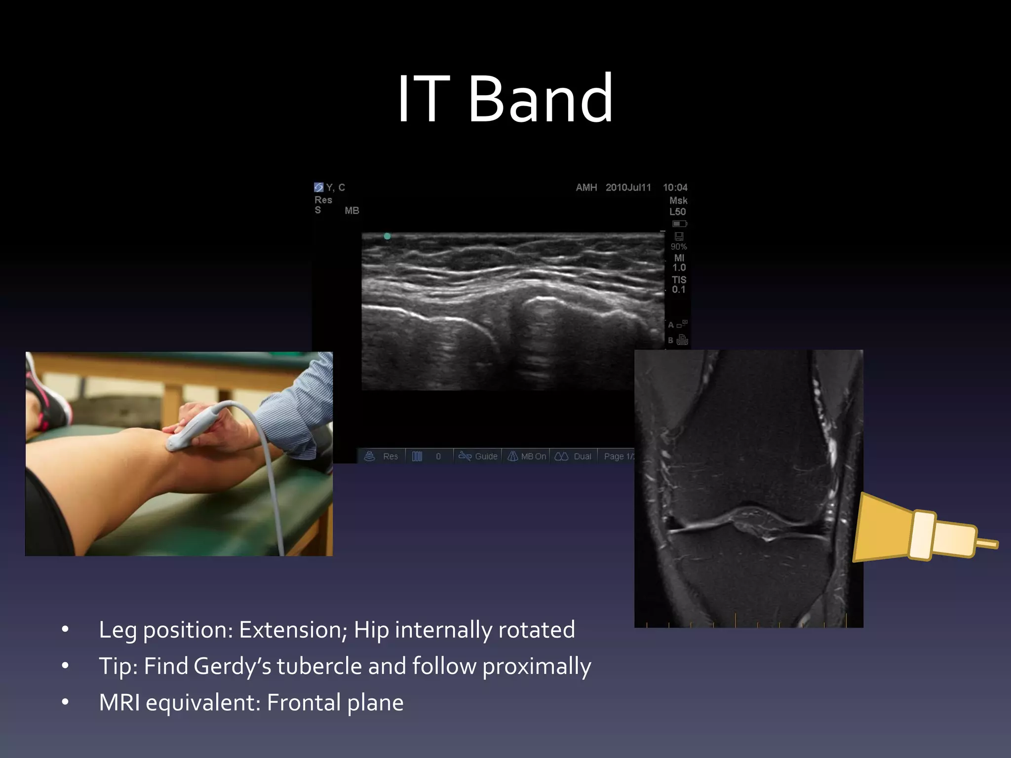 Ultrasound - Knee | PDF