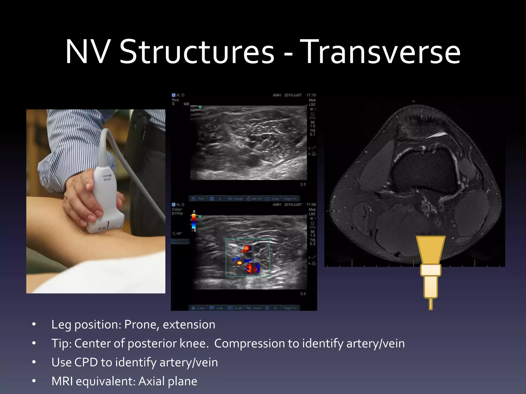 Ultrasound - Knee | PDF
