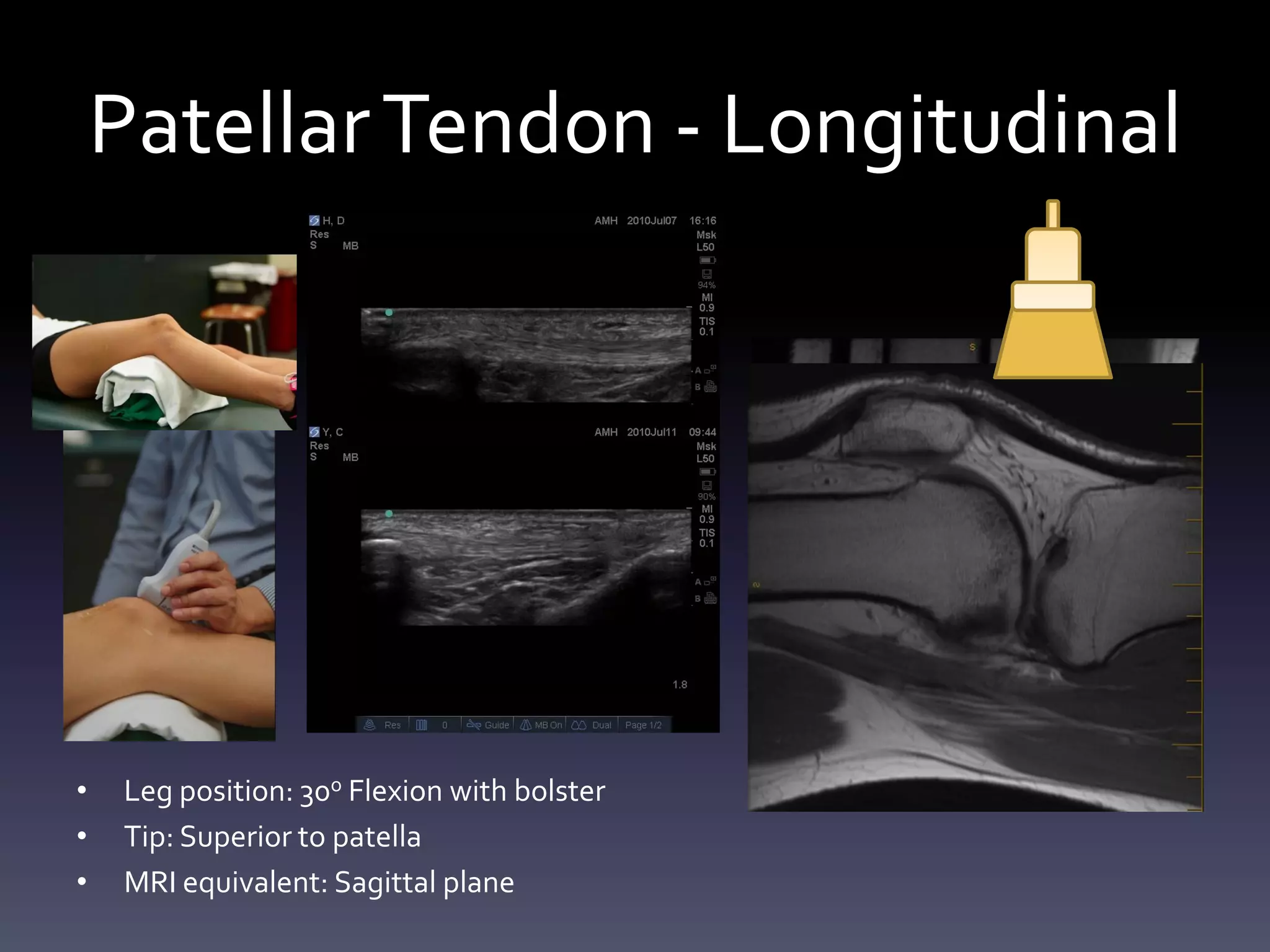 Ultrasound - Knee | PDF