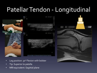 Ultrasound - Knee | PDF