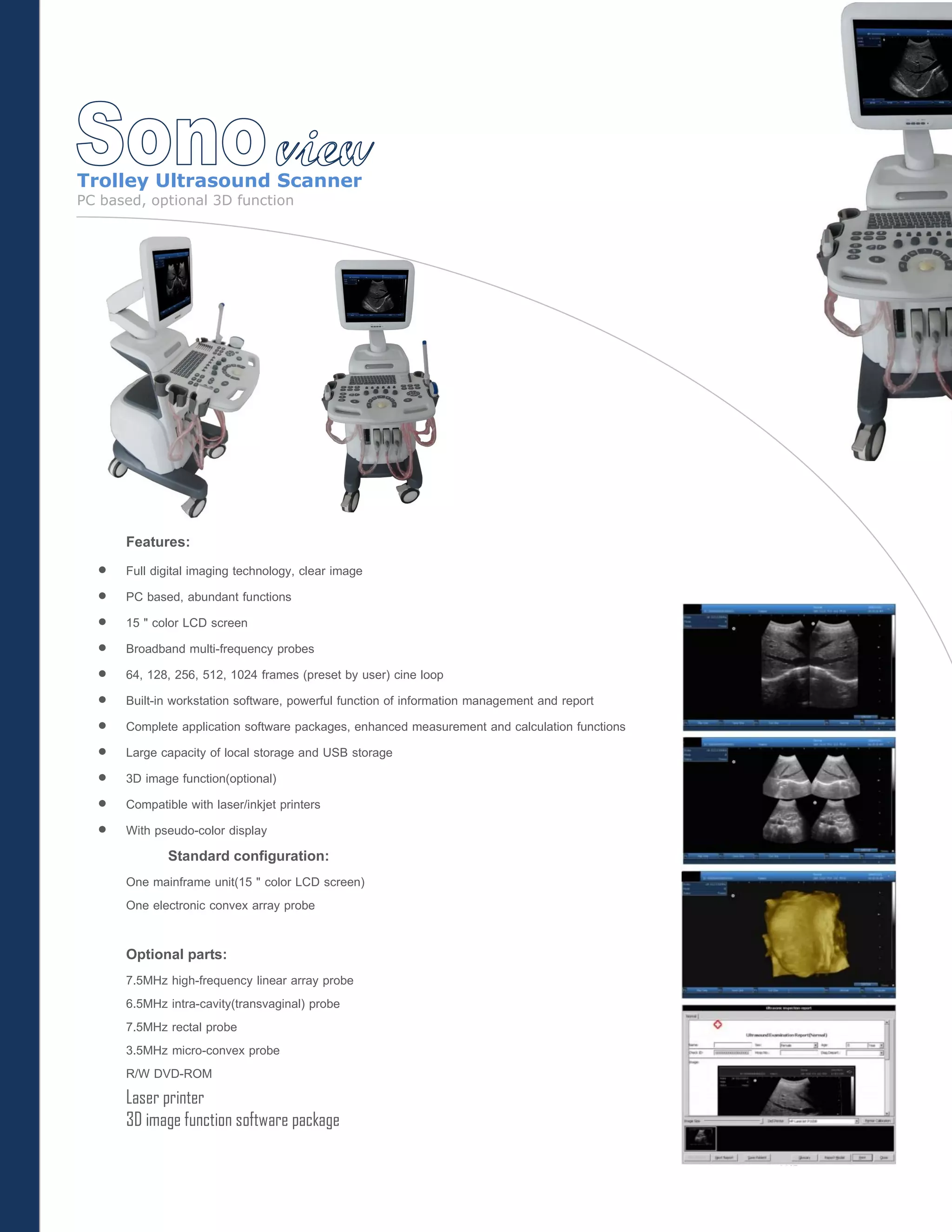 Sonoview Color Doppler Scanner | PDF