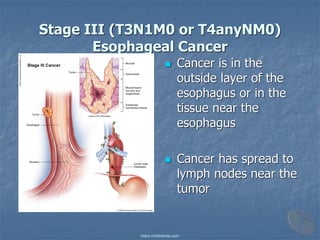 Еsophageal cancer-7.pdf oncology subject | PDF