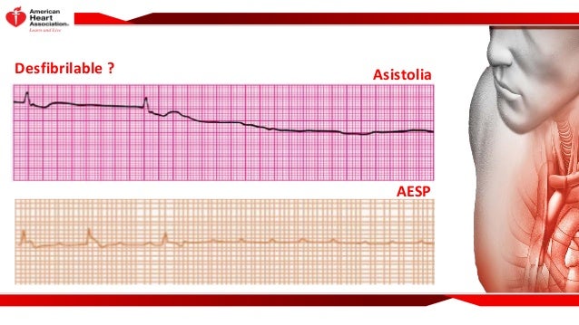 Soporte Vital Cardiopulmonar Avanzado