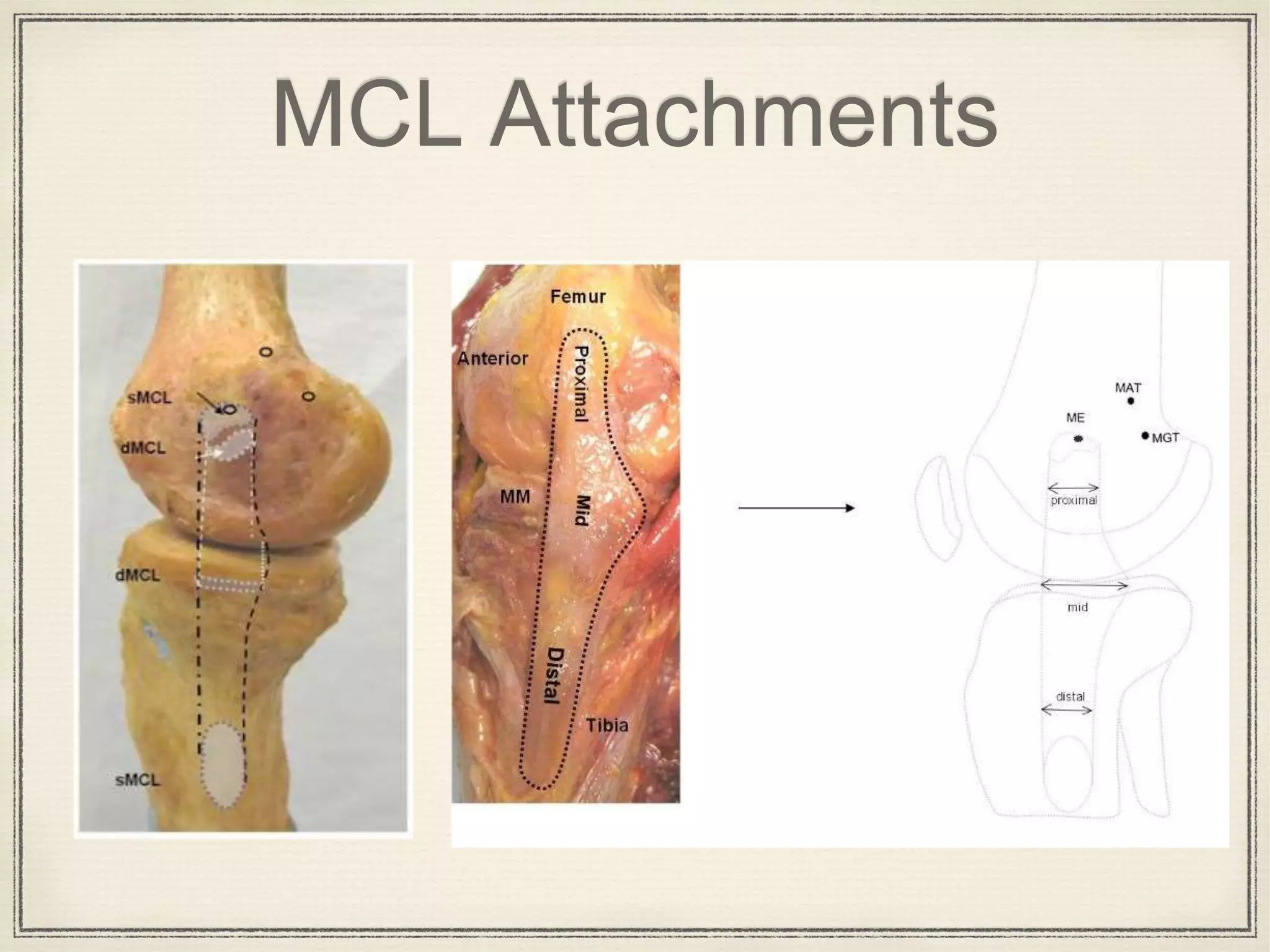 Correcting Varus Deformity of the Knee in Total Knee Replacement | PPTX