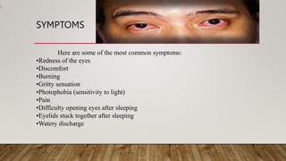 Sore Eyes.pptx