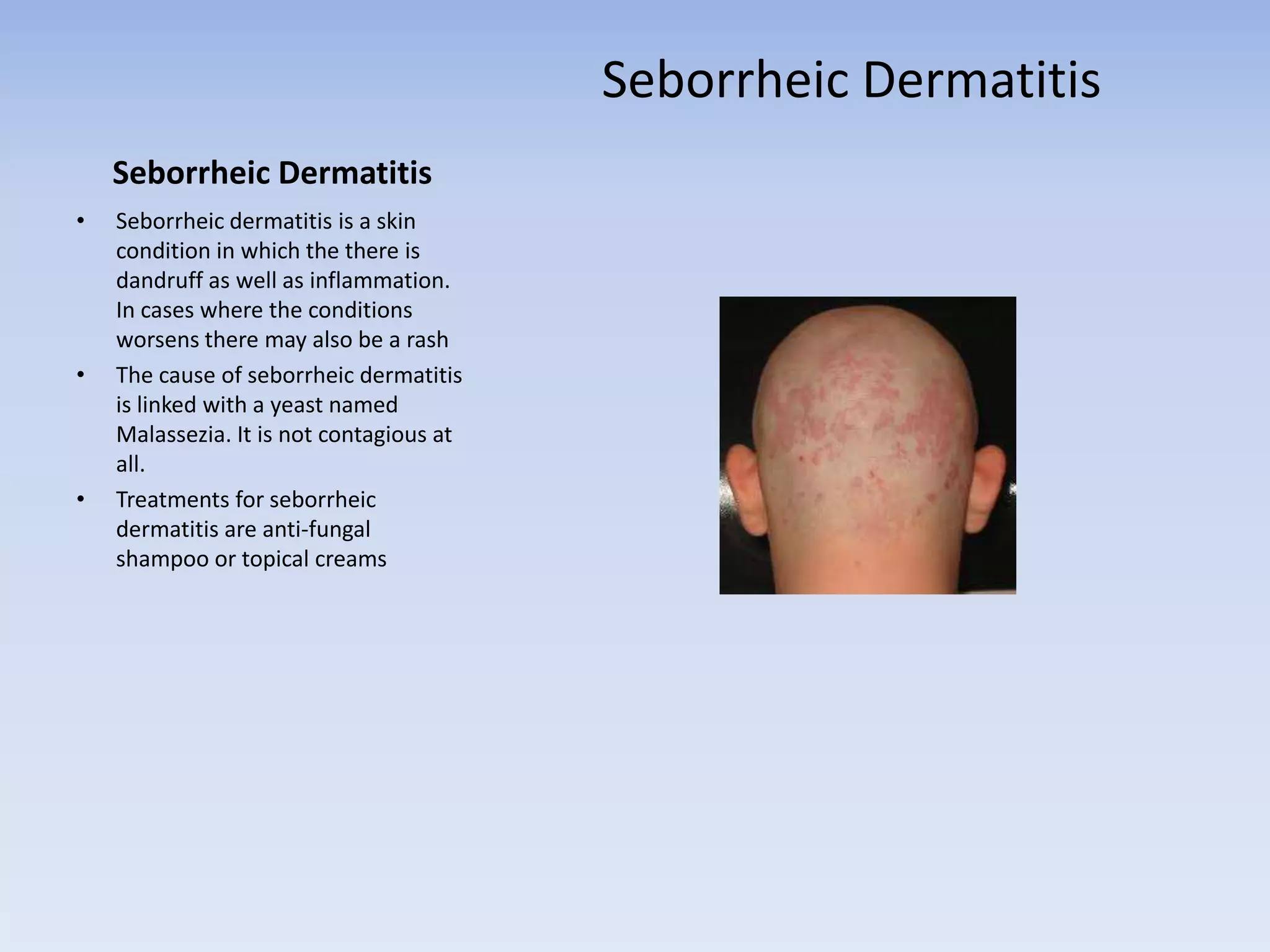 What are Common Causes of A Sore Scalp? | PPTX