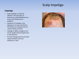 Impetigo Scalp